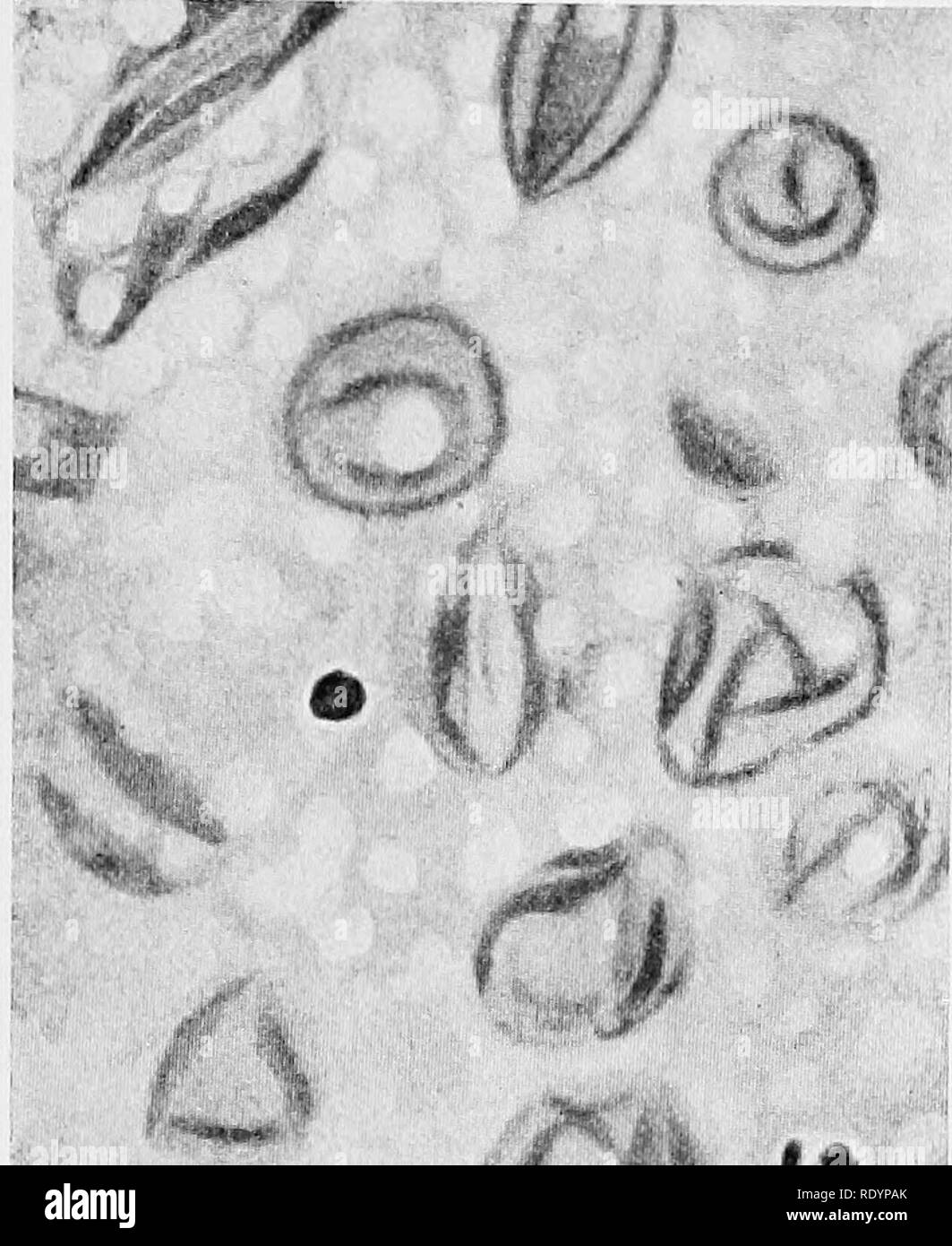 Milk derived product hi-res stock photography and images - Alamy