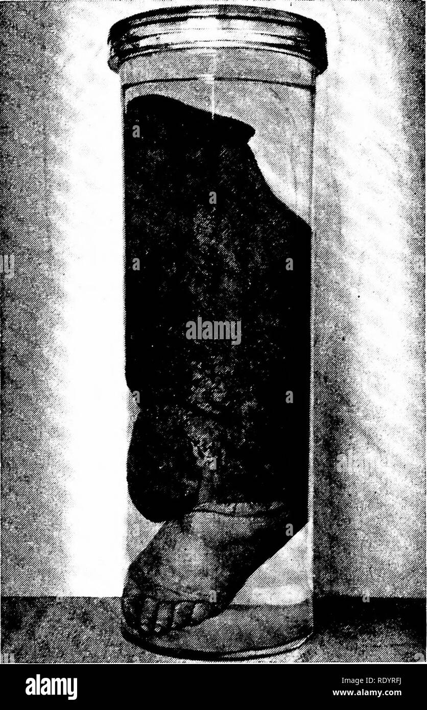 Trichinella spi hi-res stock photography and images - Alamy