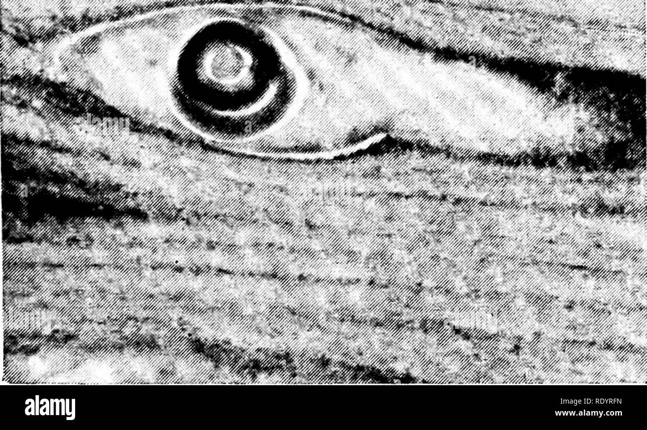 Trichinella spi hi-res stock photography and images - Alamy