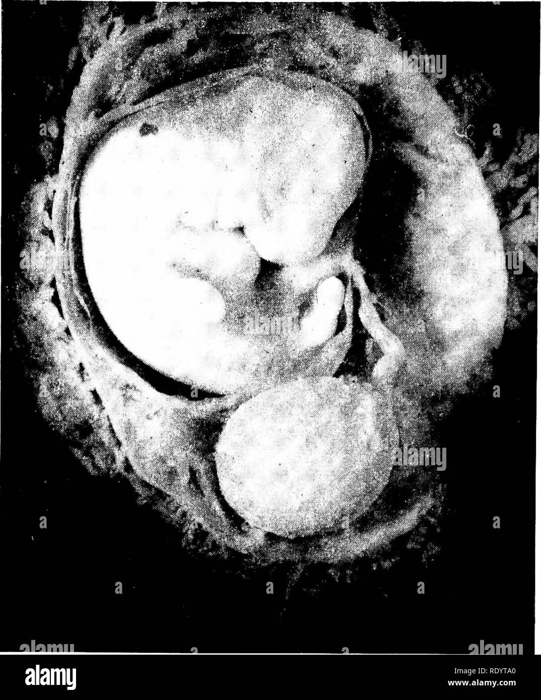 Elephant Embryo Vs Human Embryo Human Embryonic Development In Human