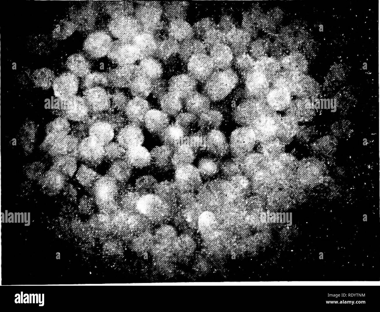 Intestin colon hi-res stock photography and images - Alamy