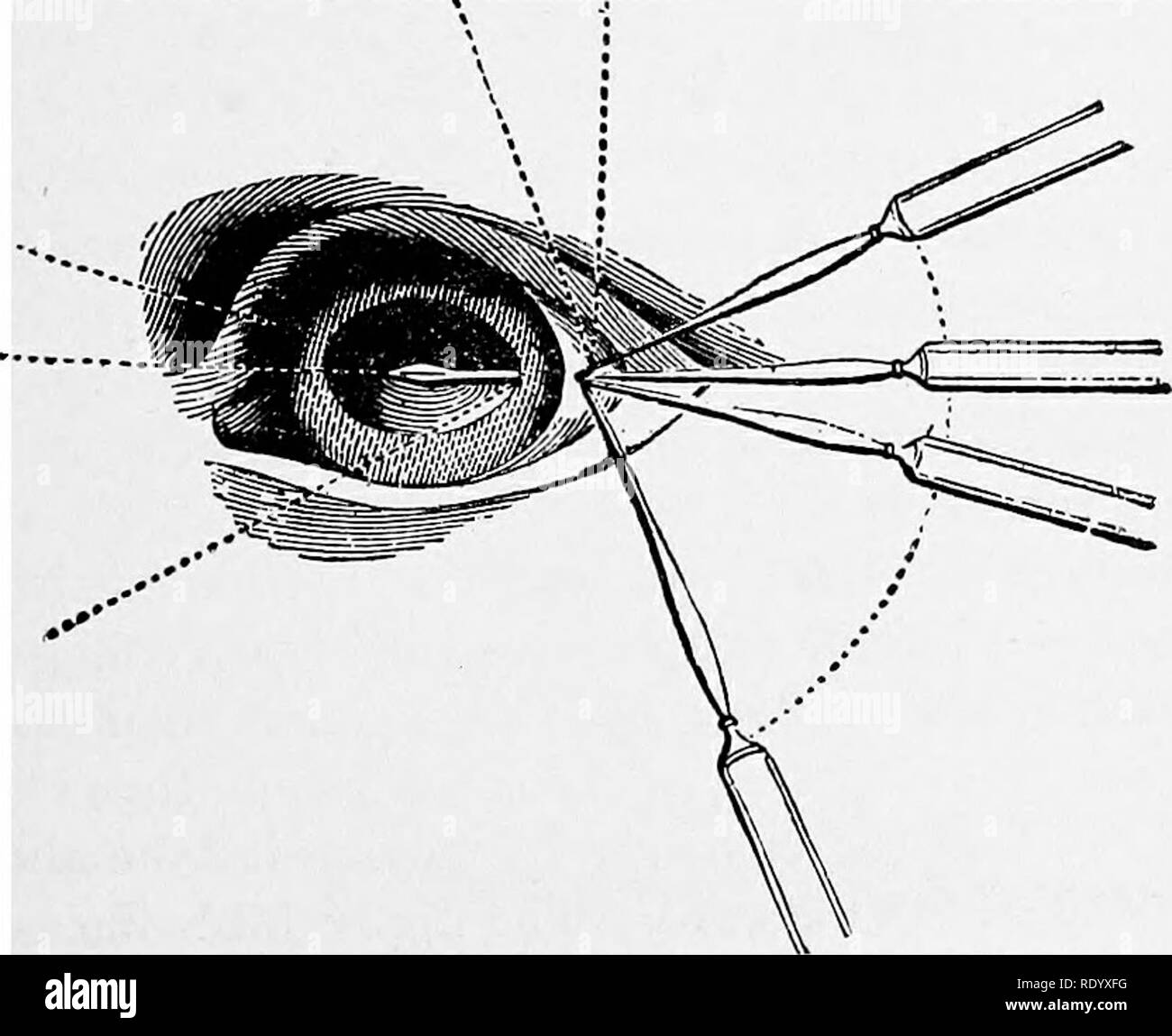 Dislocation lens hi-res stock photography and images - Alamy
