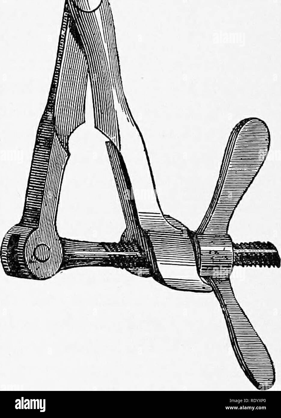 Urethrotomy hi-res stock photography and images - Alamy