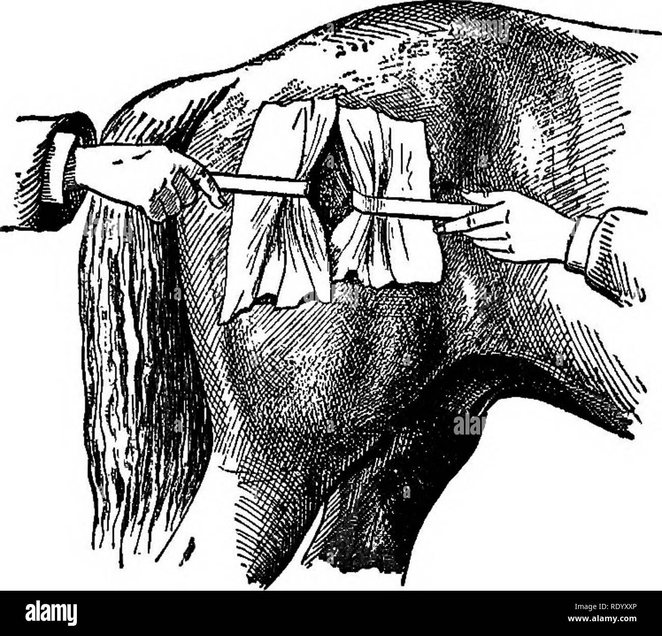 Cauterization Cut Out Stock Images & Pictures - Alamy