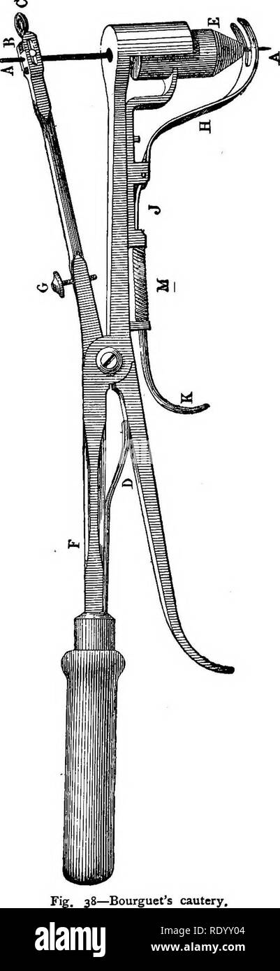 Cauterizing Black and White Stock Photos & Images - Alamy