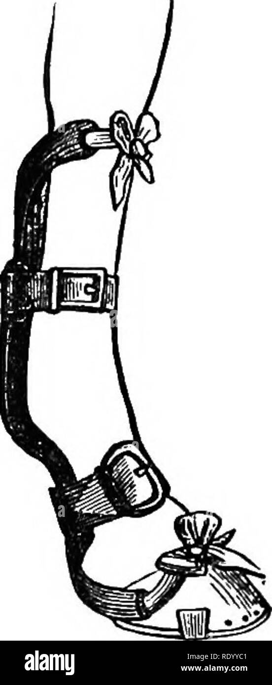 Splint images hi-res stock photography and images - Alamy