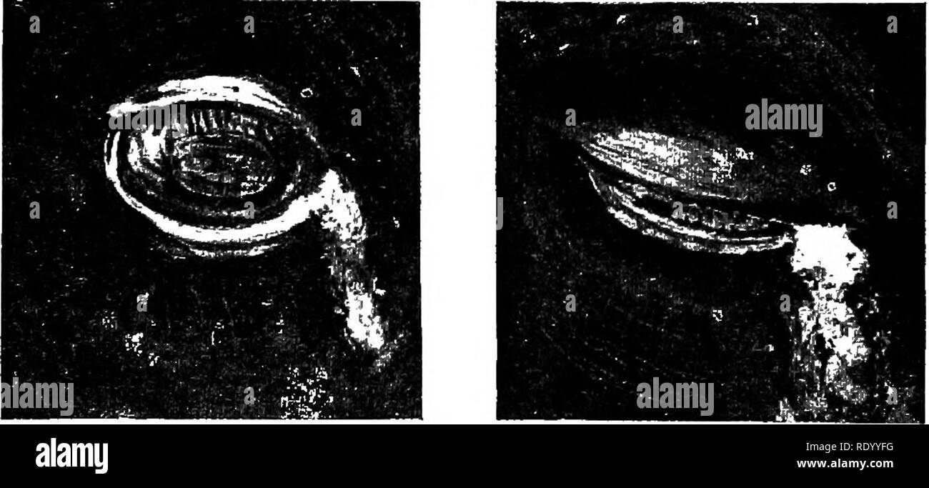 Conjunctival sac hi-res stock photography and images - Alamy