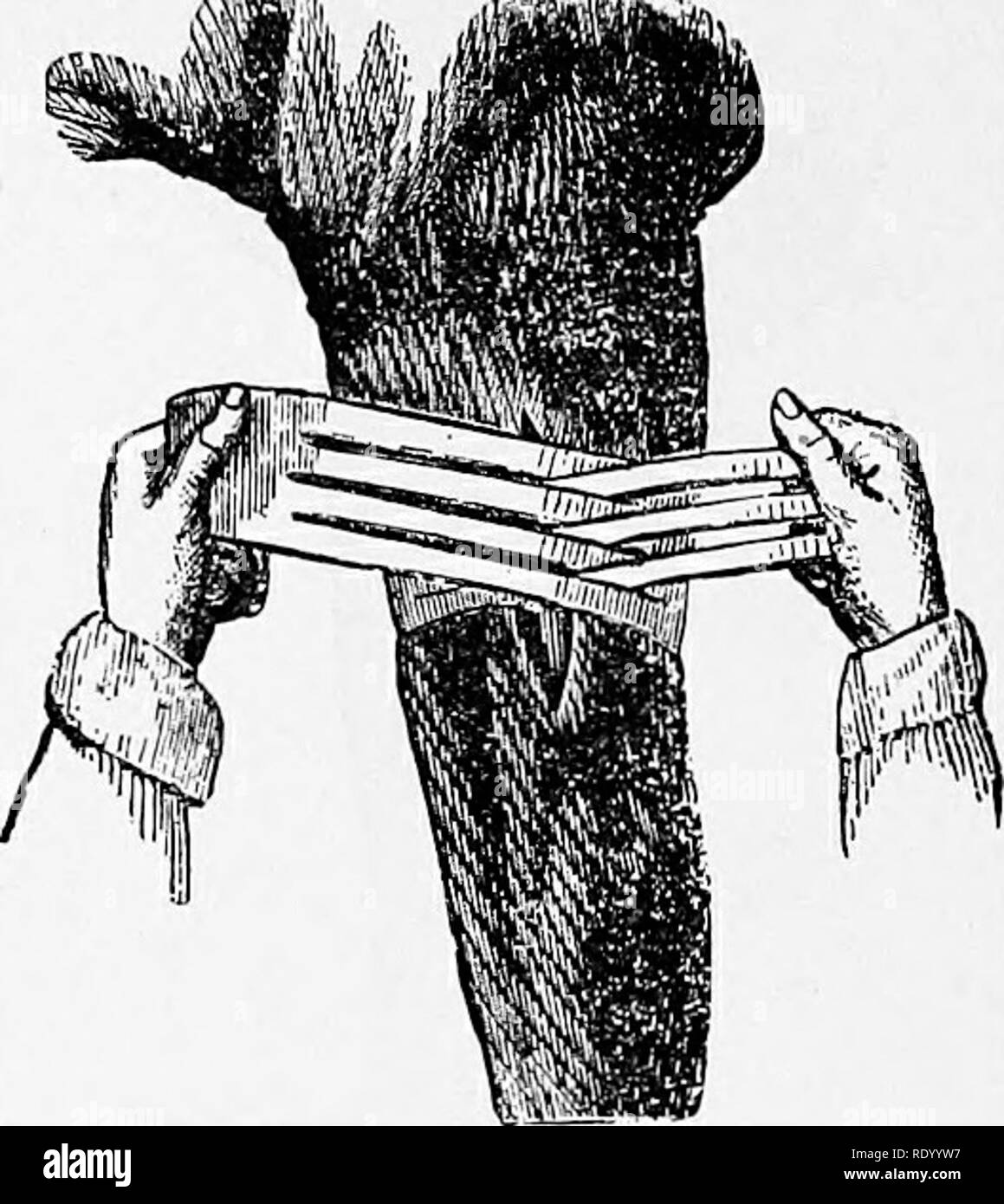 Longitudinal bandages Black and White Stock Photos & Images - Alamy