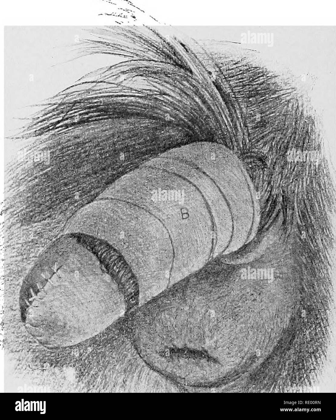. Surgical and obstetrical operations. Veterinary surgery. FIG. 37 ...