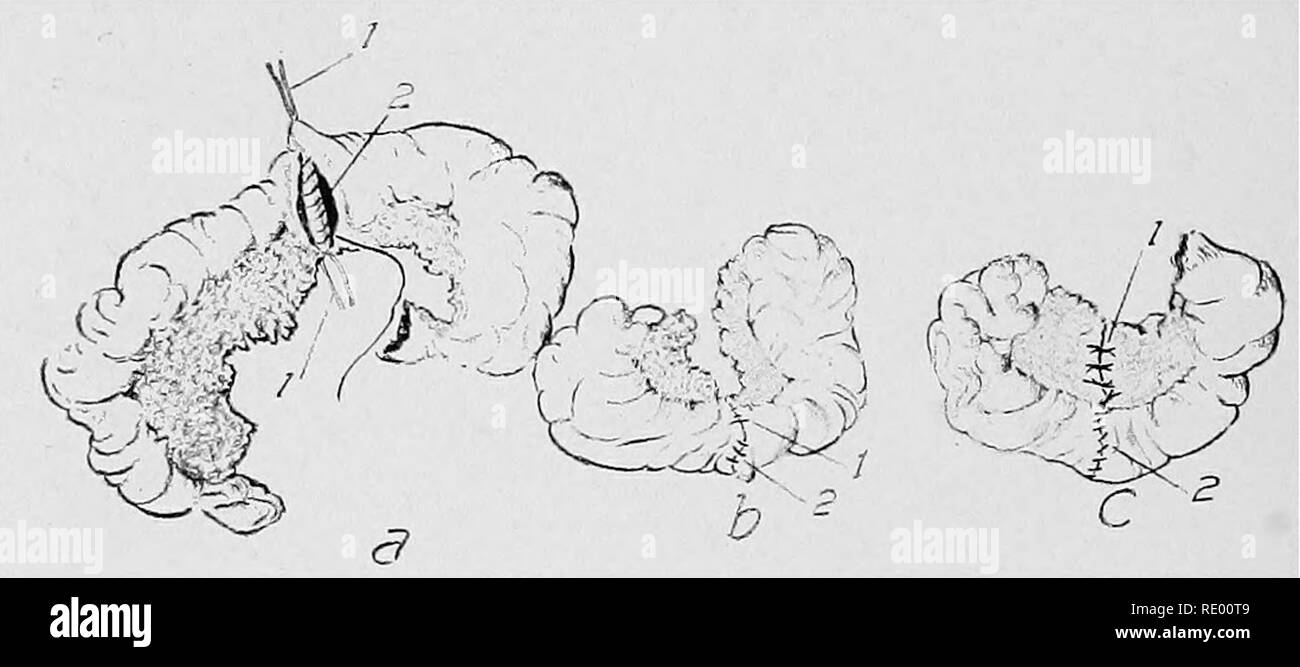 . Surgical and obstetrical operations. Veterinary surgery. 86 RESECTION ...