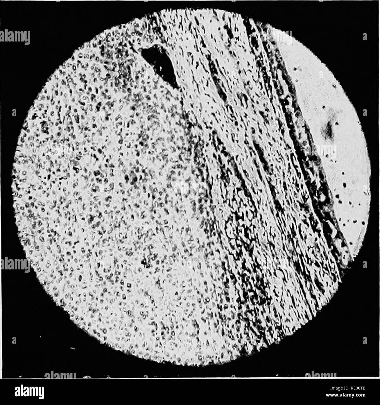 Granulation Tissue Black and White Stock Photos & Images - Alamy