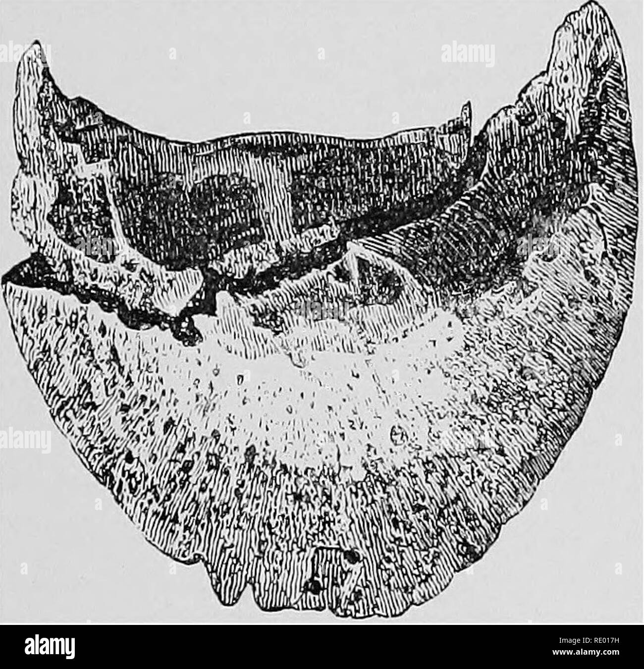 Pus wound Black and White Stock Photos & Images - Alamy