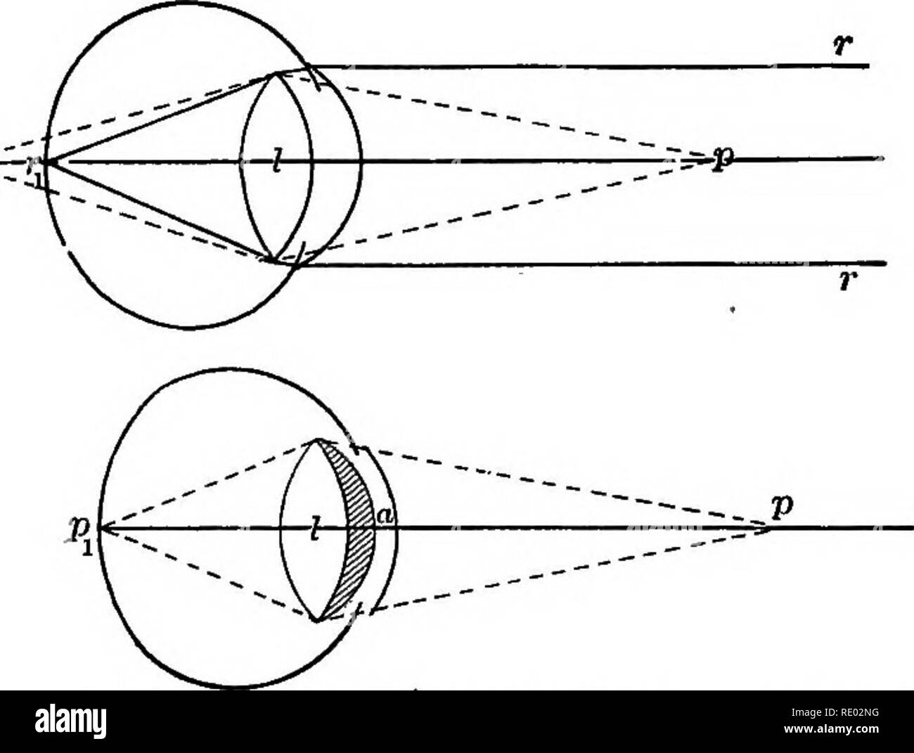 Normal retina Cut Out Stock Images & Pictures - Alamy