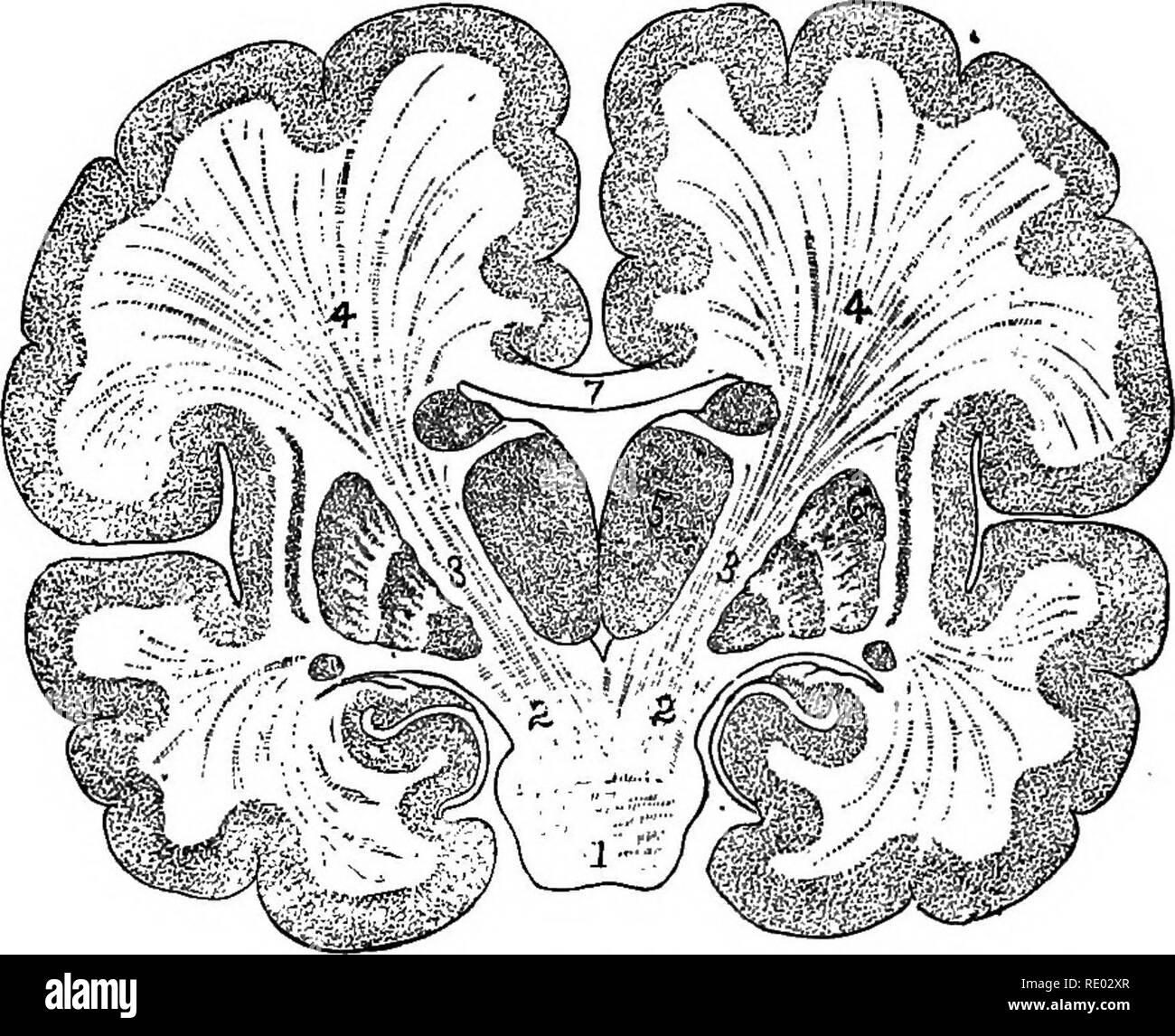 Akinesia hi-res stock photography and images - Alamy