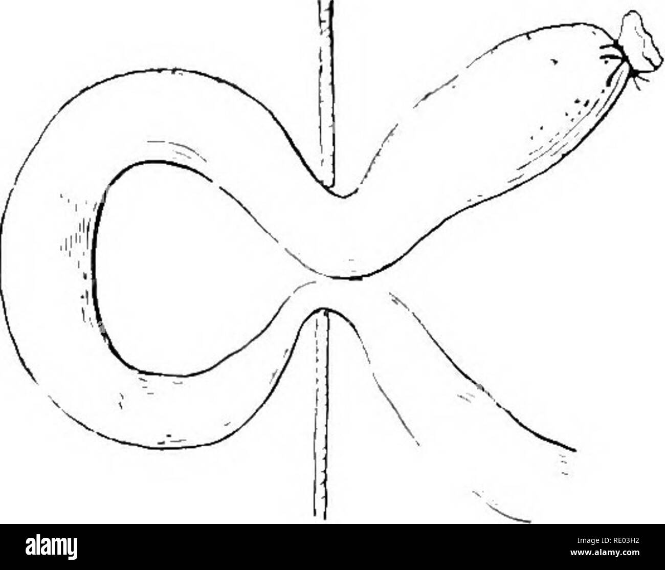 Epiploon hi-res stock photography and images - Alamy