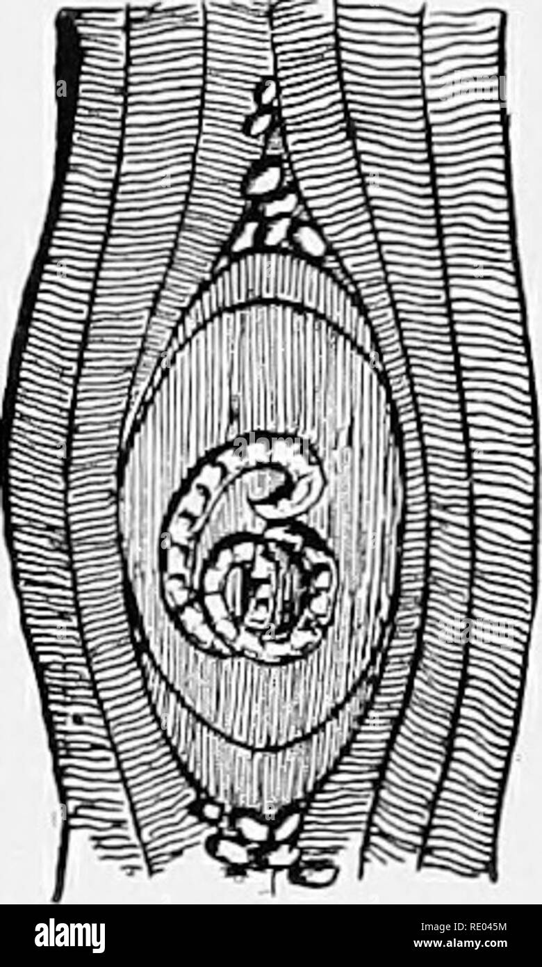 Trichina spiralis hi-res stock photography and images - Alamy