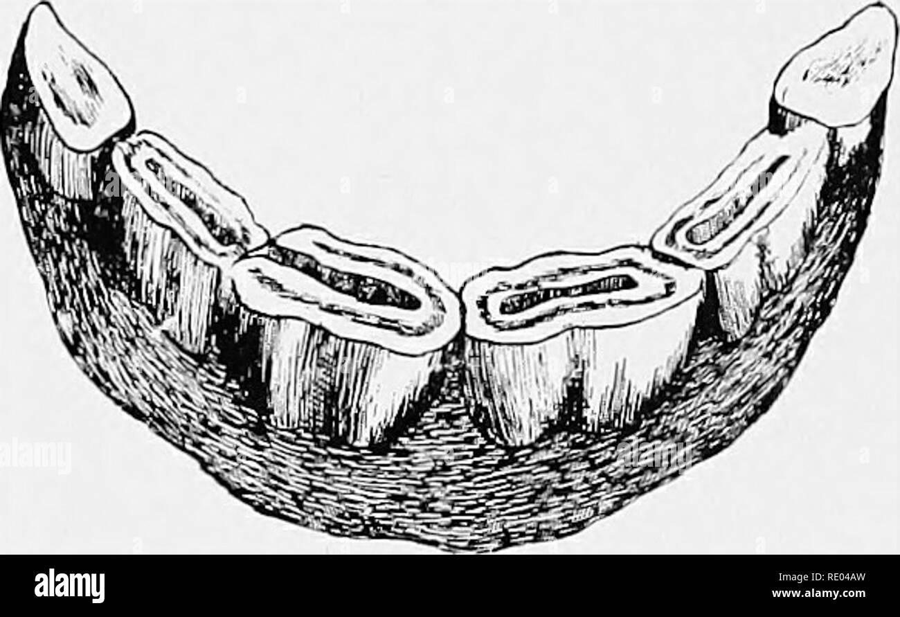 Fourth molar hi-res stock photography and images - Alamy