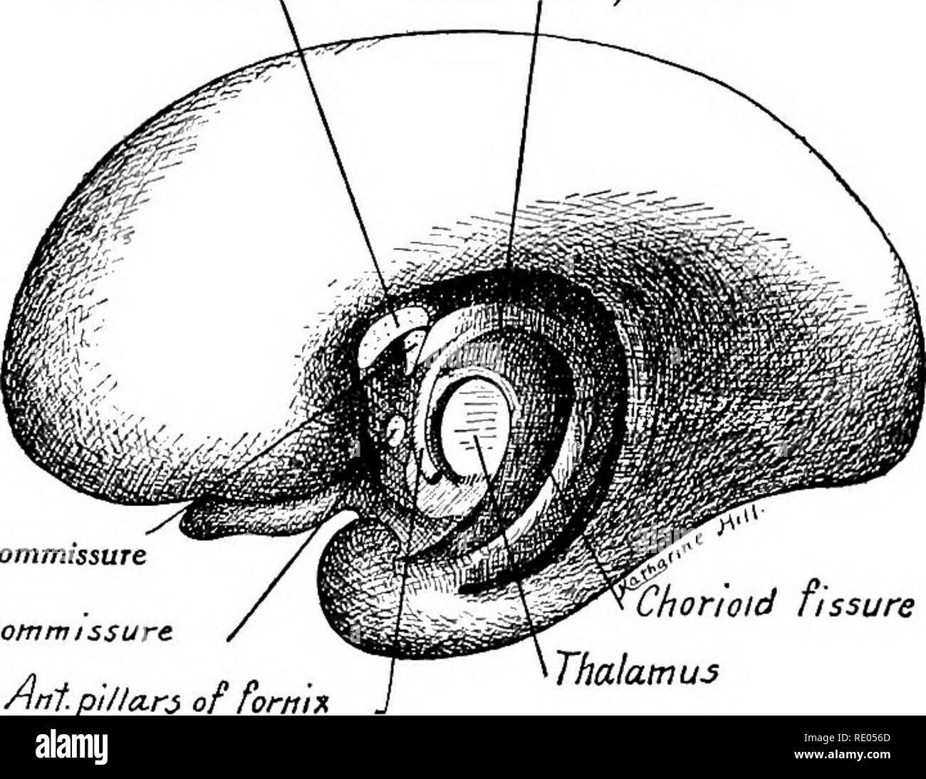 Corpus callosum Black and White Stock Photos & Images - Alamy