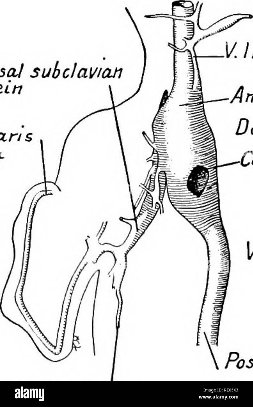 Vena saphena magna hi-res stock photography and images - Alamy