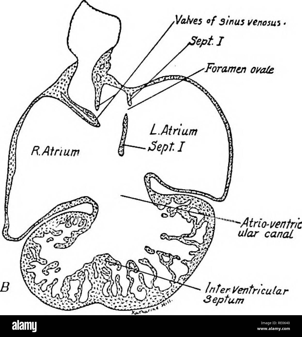 Interventricular Septum Embryology