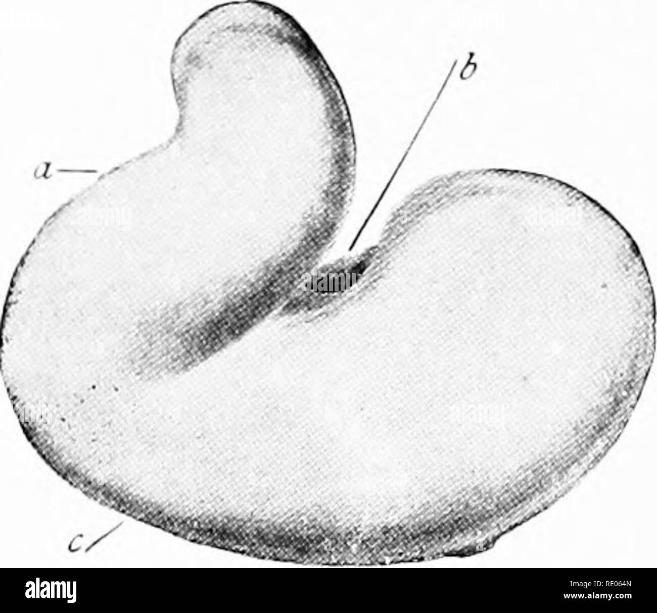 Left atrial appendage Black and White Stock Photos & Images - Alamy