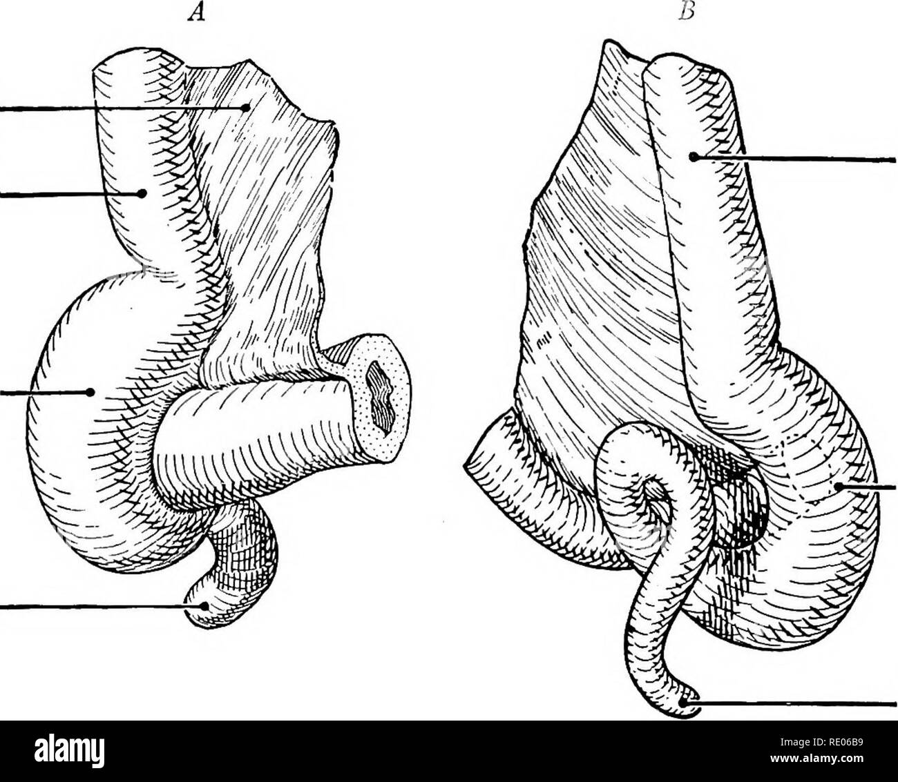 Vermiform Appendix Stock Photos & Vermiform Appendix Stock Images - Alamy