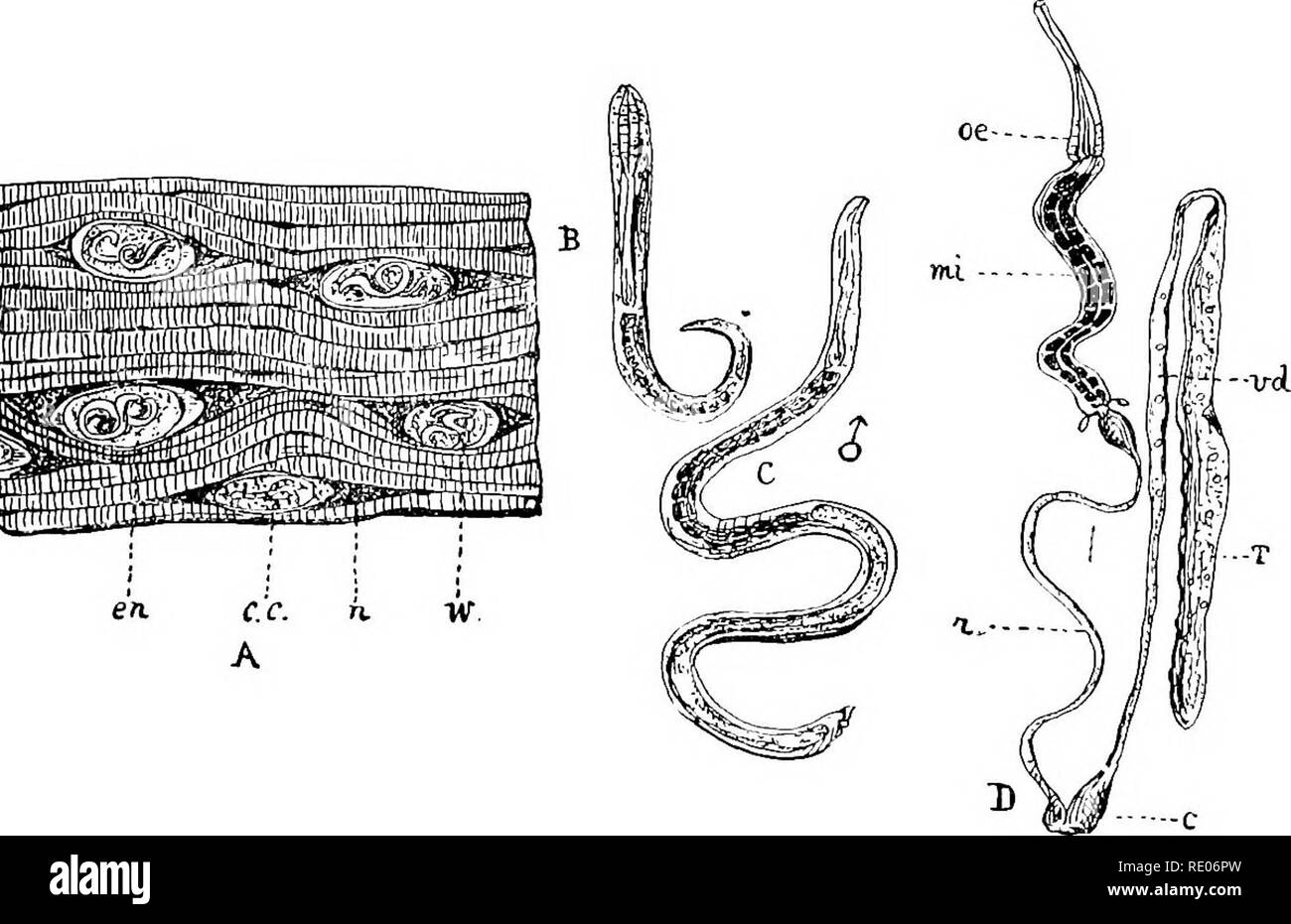 Trichina spiralis hi-res stock photography and images - Alamy