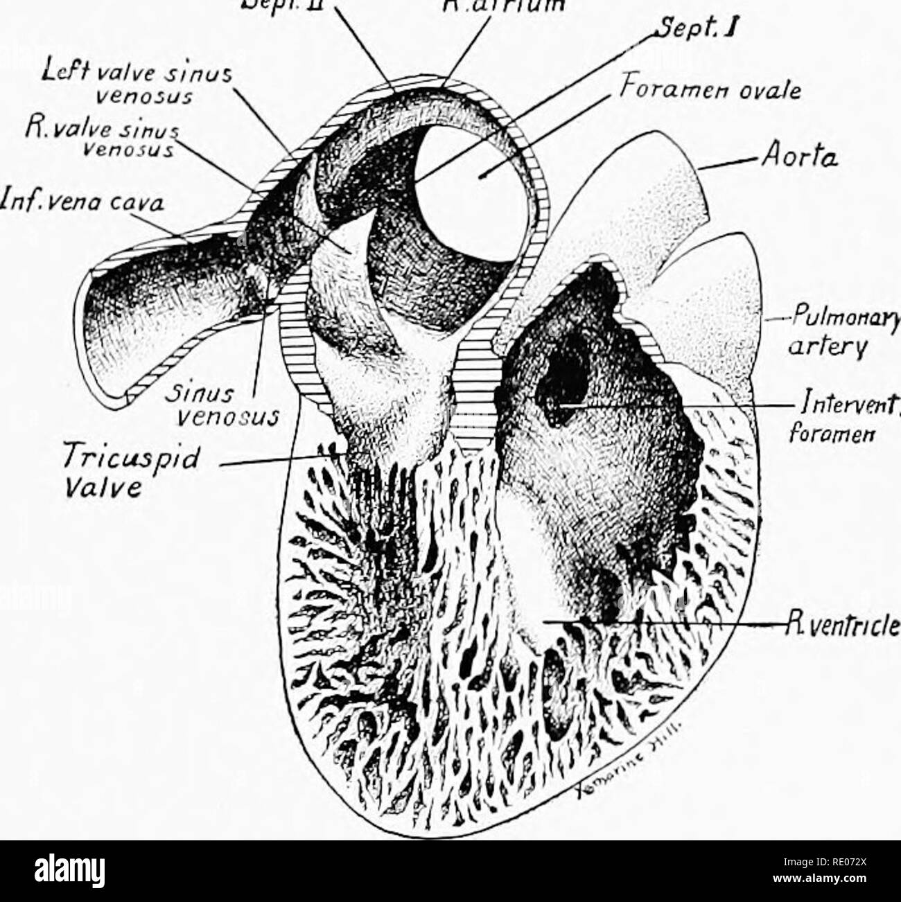 Pulmonary Trunk High Resolution Stock Photography and Images - Alamy