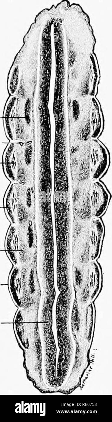 Sections small intestine hi-res stock photography and images - Alamy