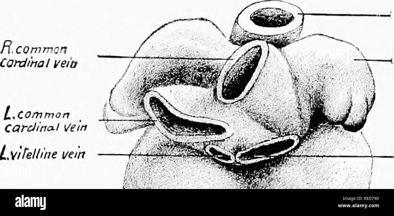 Right transverse sinus Black and White Stock Photos & Images - Alamy