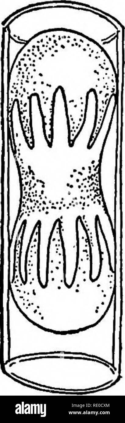 Polyp oral Black and White Stock Photos & Images - Alamy