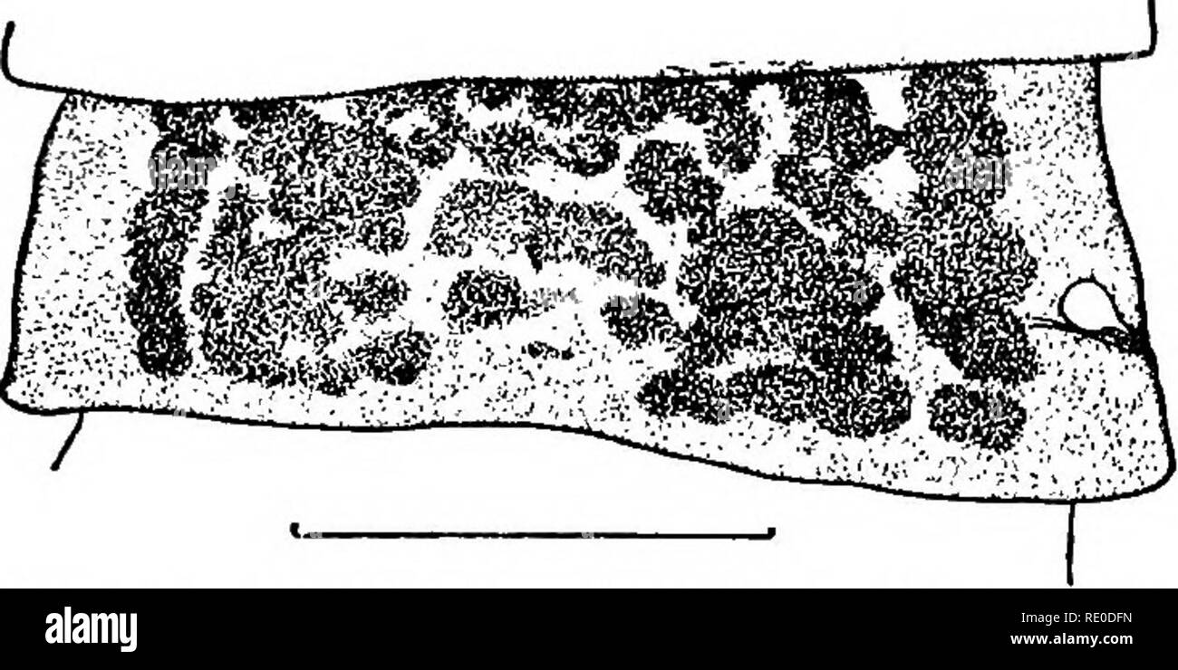 Tapeworm eggs hi-res stock photography and images - Alamy