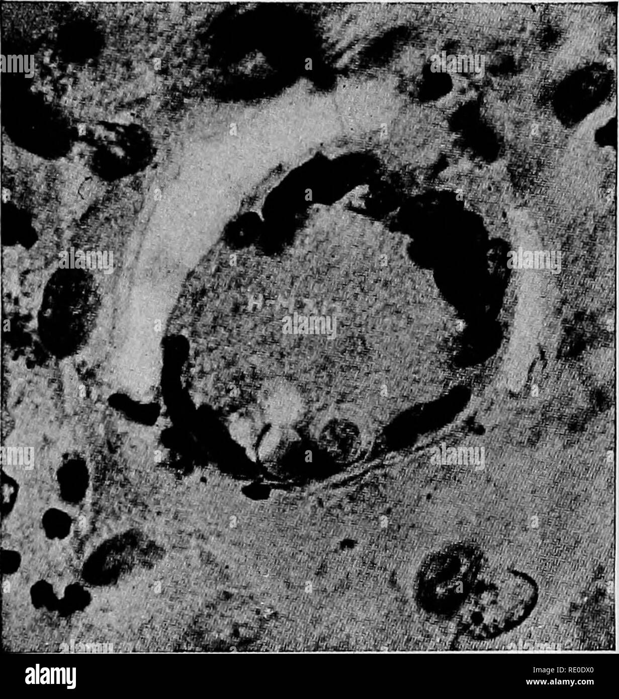 Elliptical spores hi-res stock photography and images - Alamy