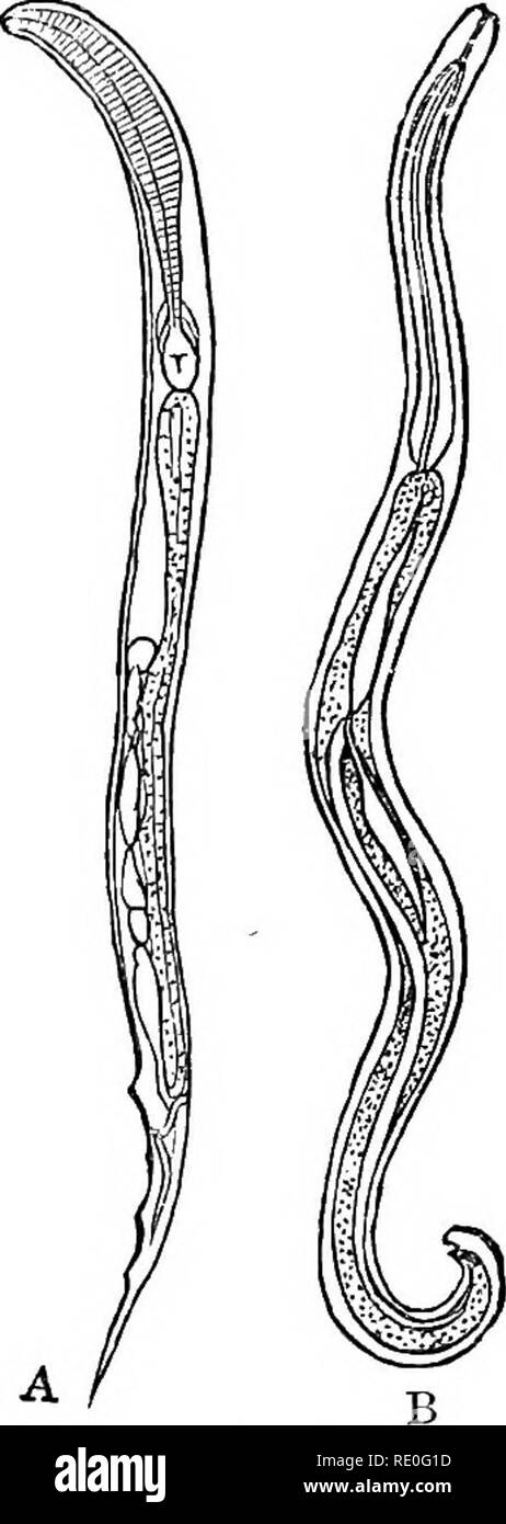 Guinea worm and man hi-res stock photography and images - Alamy