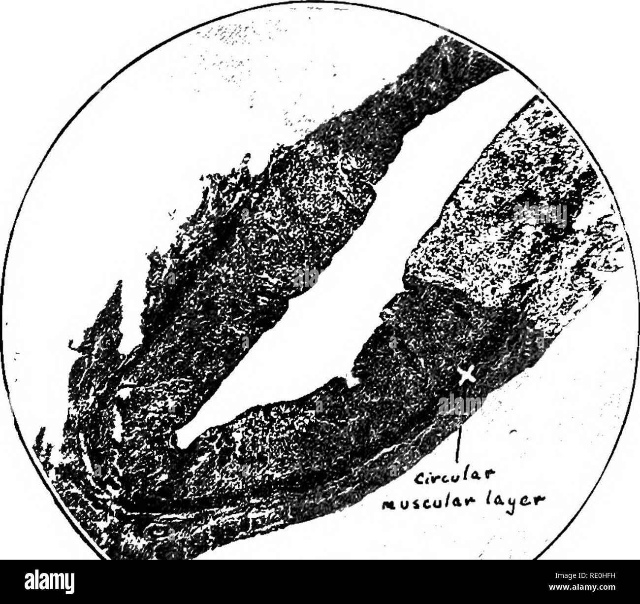 Ovaries uterus Black and White Stock Photos & Images - Alamy