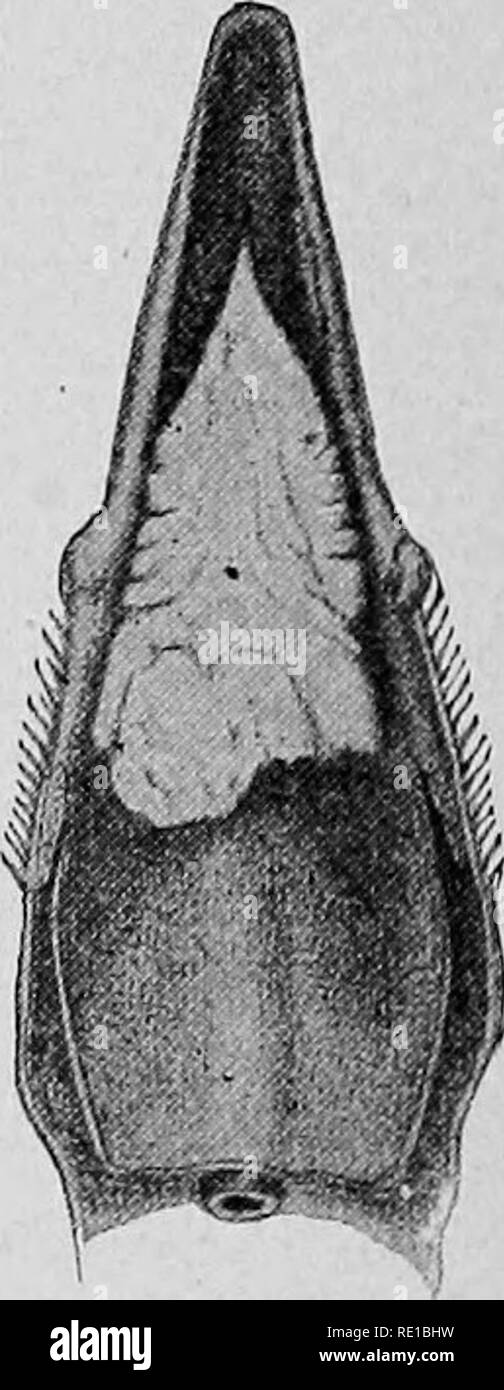 Diphtheria Throat High Resolution Stock Photography and Images - Alamy