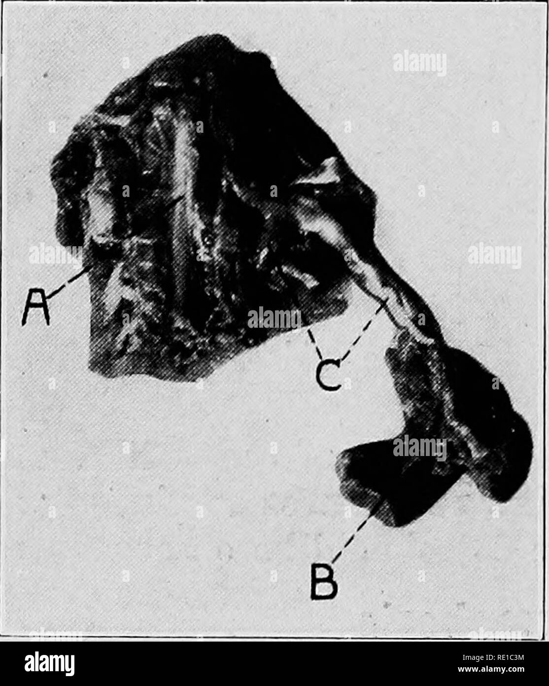 Leg septicemia Black and White Stock Photos & Images - Alamy