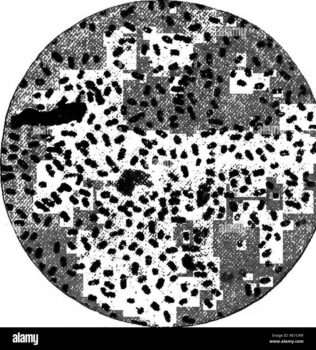 Septicemic Plague Bacteria
