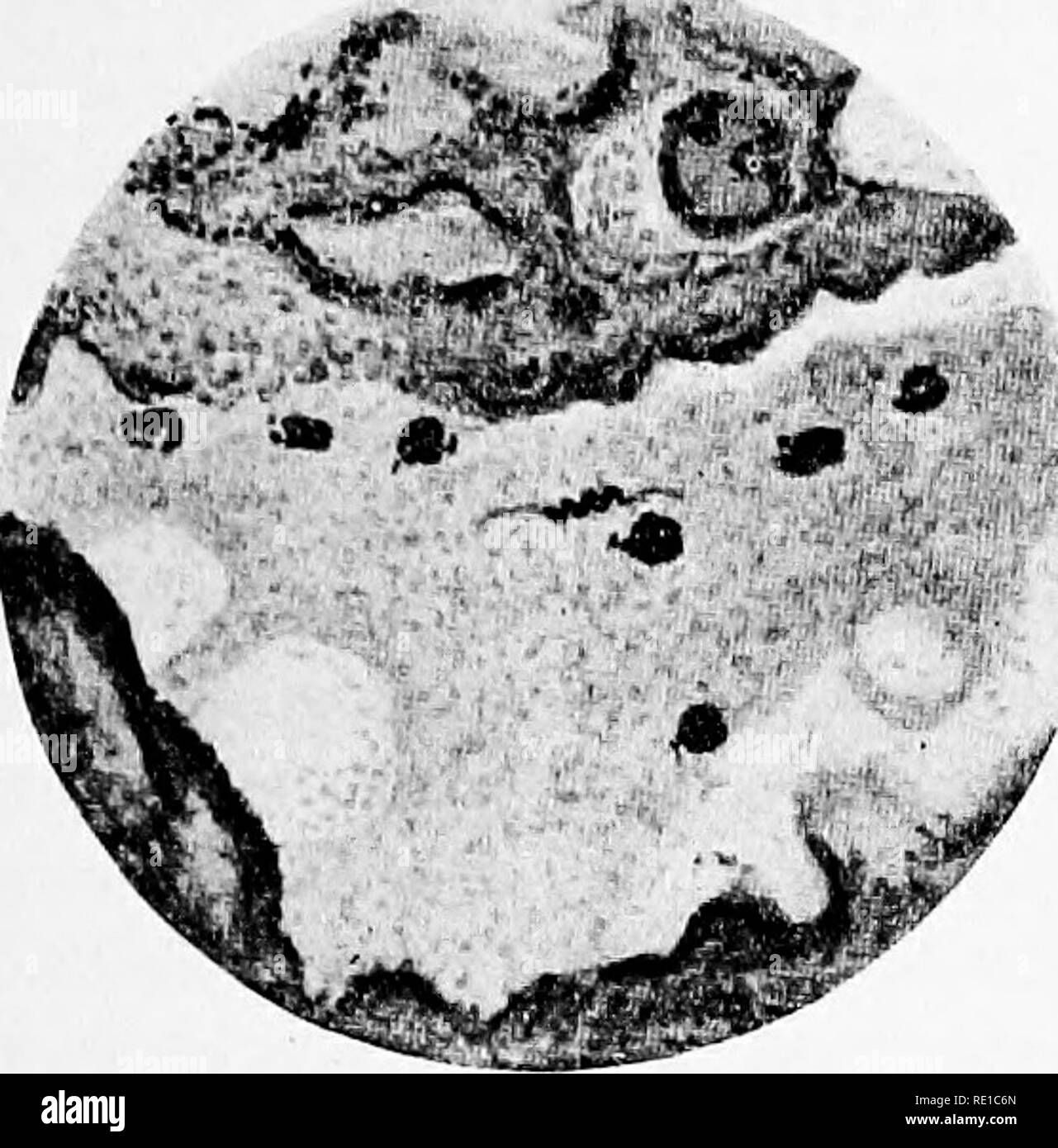 Rat bite fever bacteria hi-res stock photography and images - Alamy