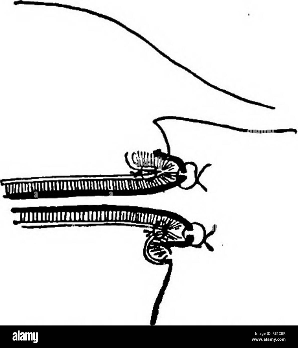 Surgical stitches Black and White Stock Photos & Images - Alamy