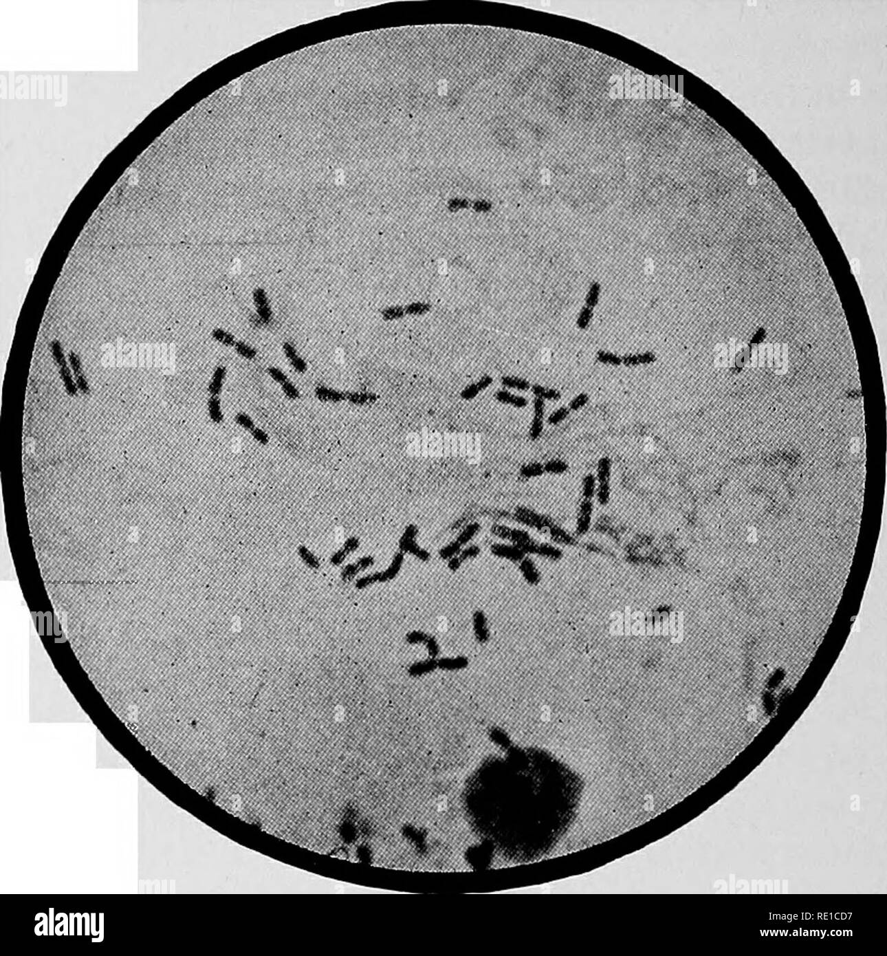 Diplobacilli Bacteria