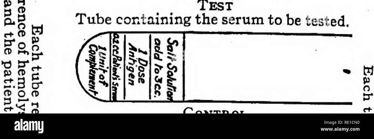 Syphilis test hi-res stock photography and images - Alamy