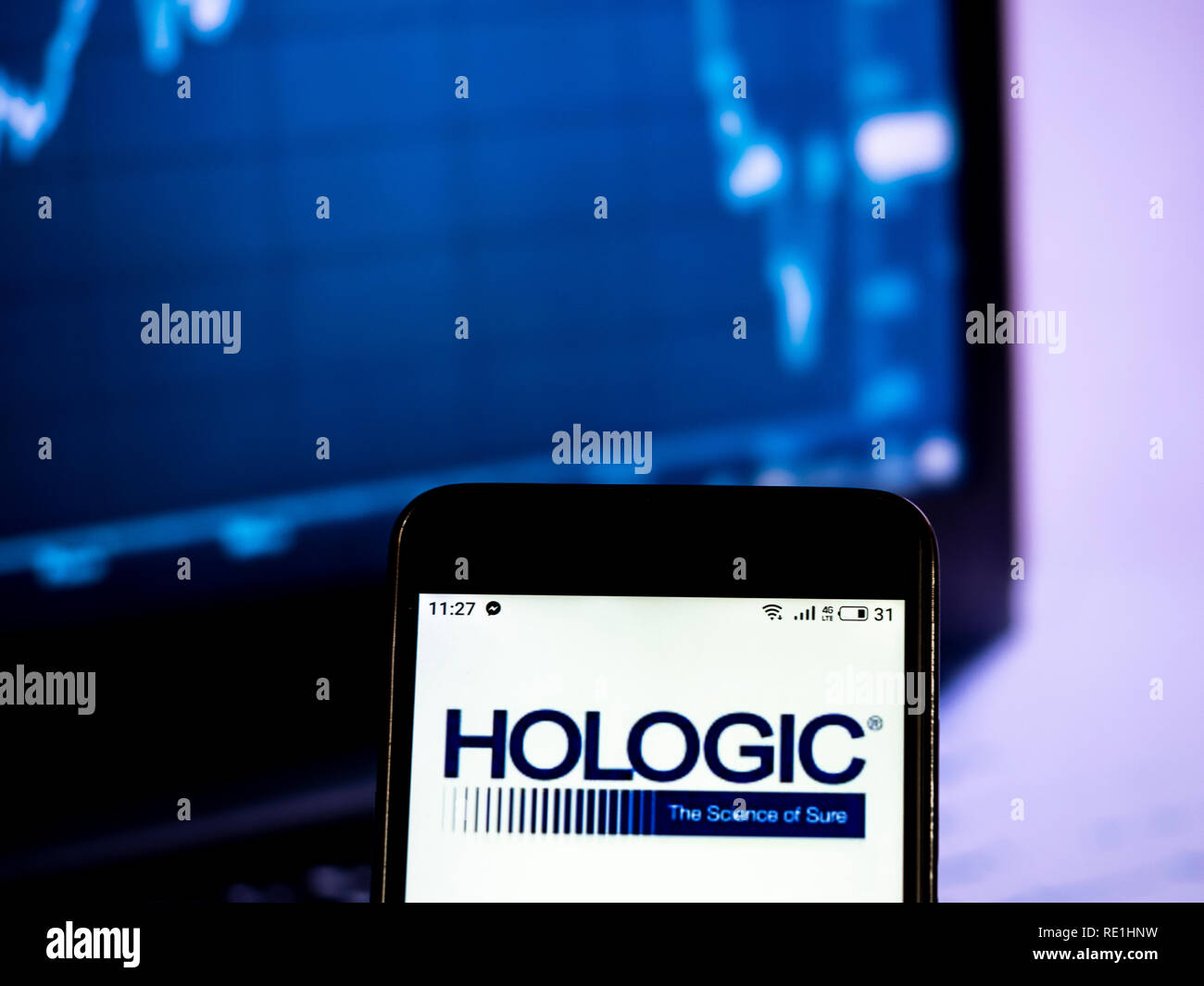 Hologic Medical device company logo seen displayed on smart phone Stock ...