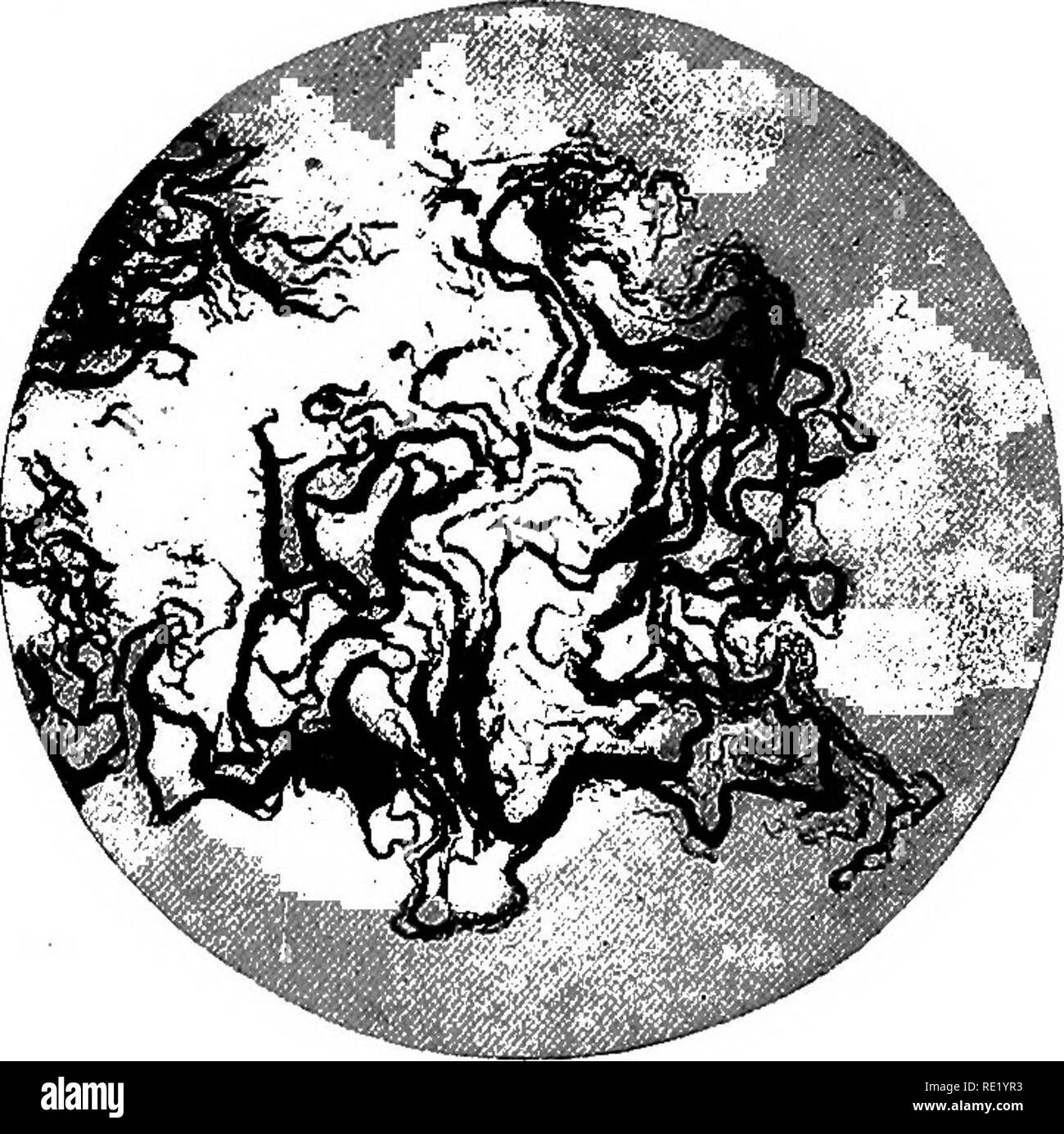 Tubercle bacteria hi-res stock photography and images - Alamy