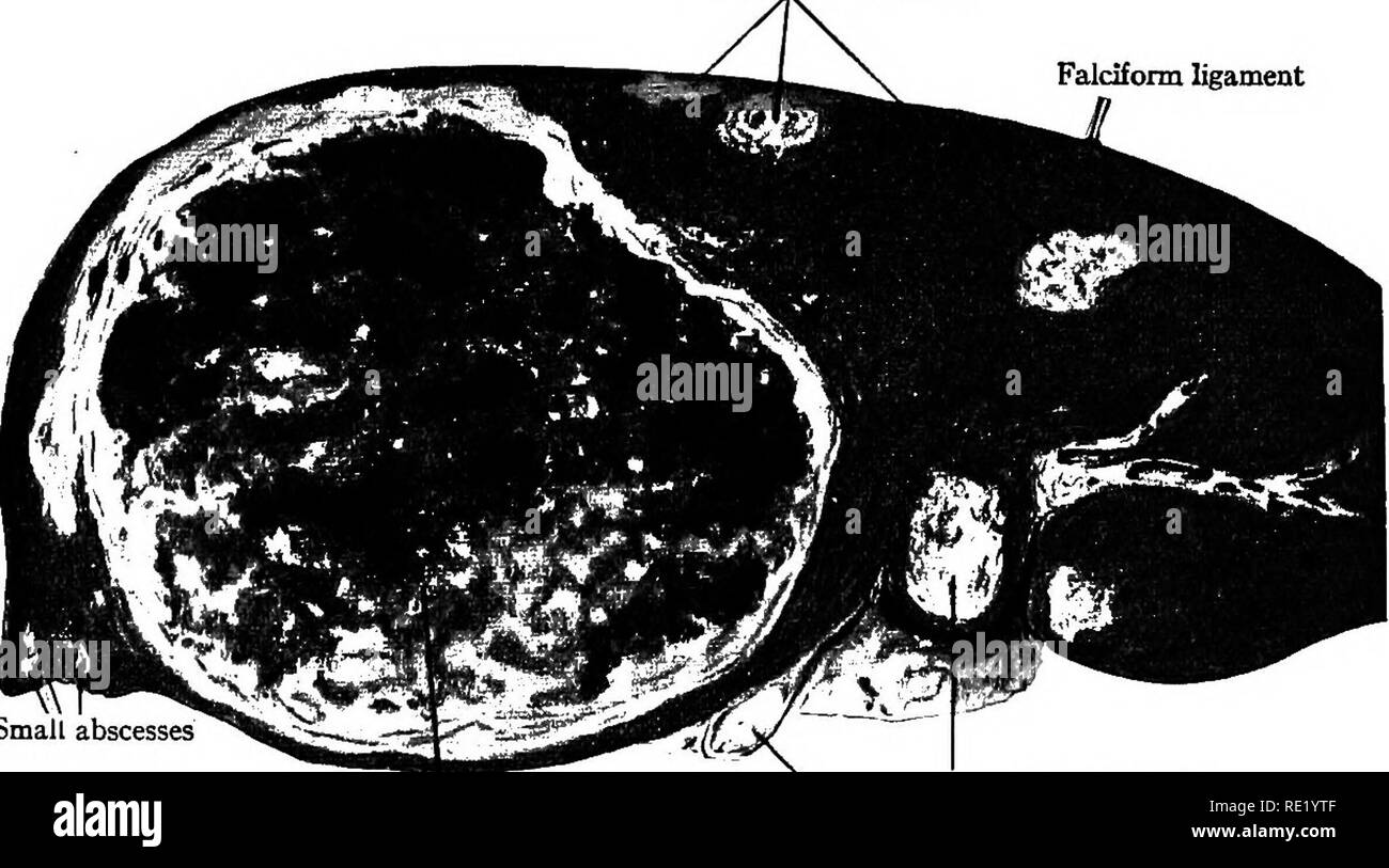 Died from dysentery hi-res stock photography and images - Alamy