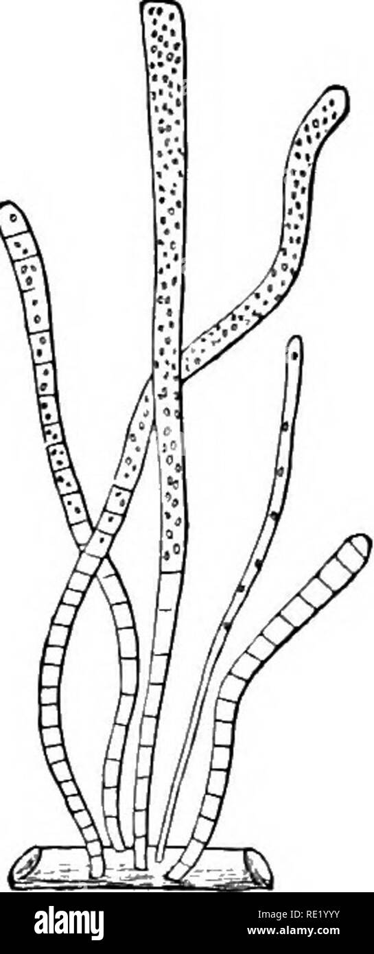 Beggiatoa winogradsky hi-res stock photography and images - Alamy