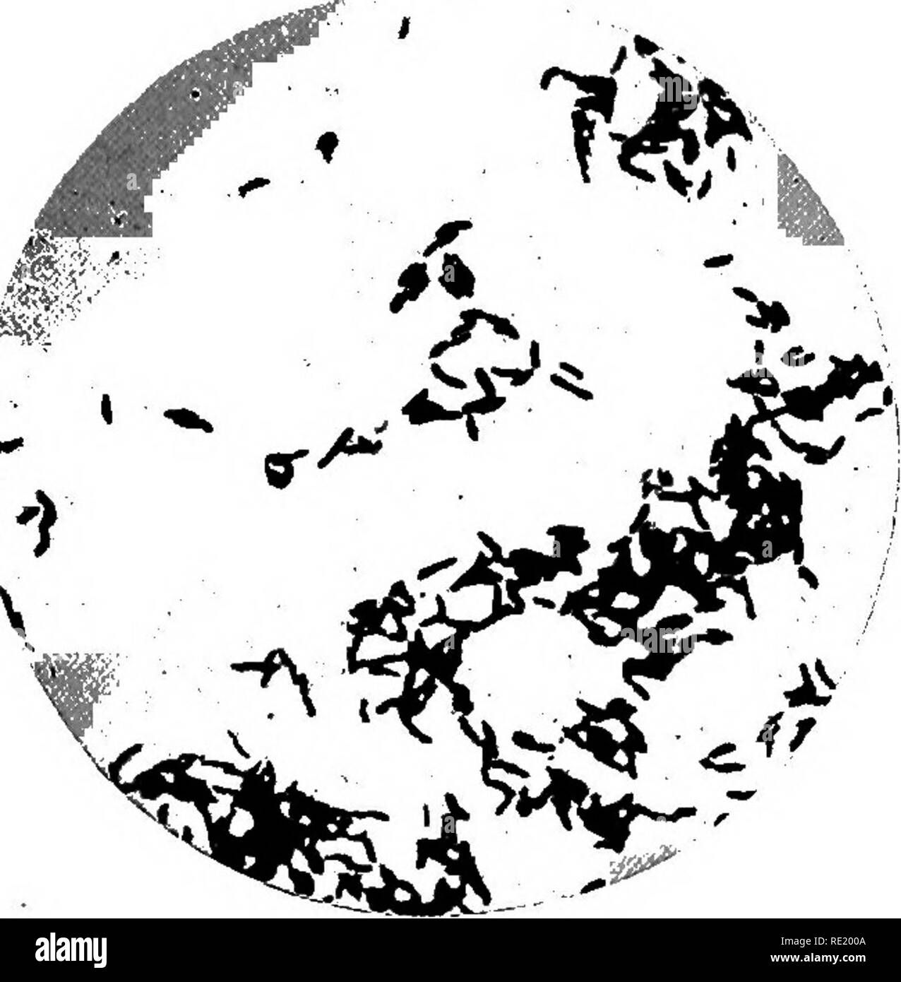 Cheese bacteria 1000 hi-res stock photography and images - Alamy