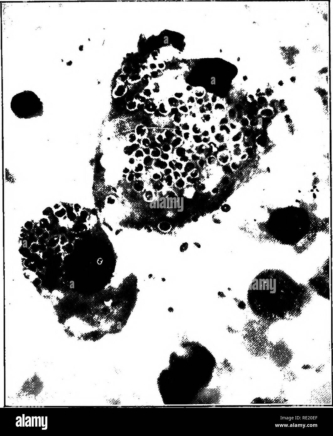 Leishman donovan body hi-res stock photography and images - Alamy