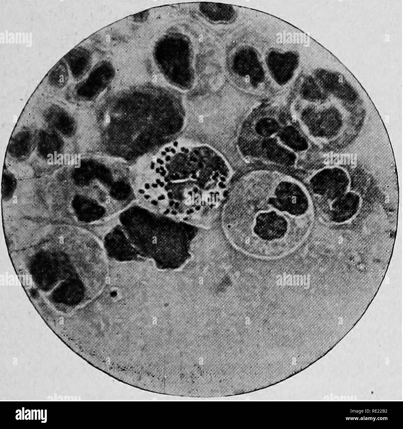 Intramuscular injections Black and White Stock Photos & Images - Alamy