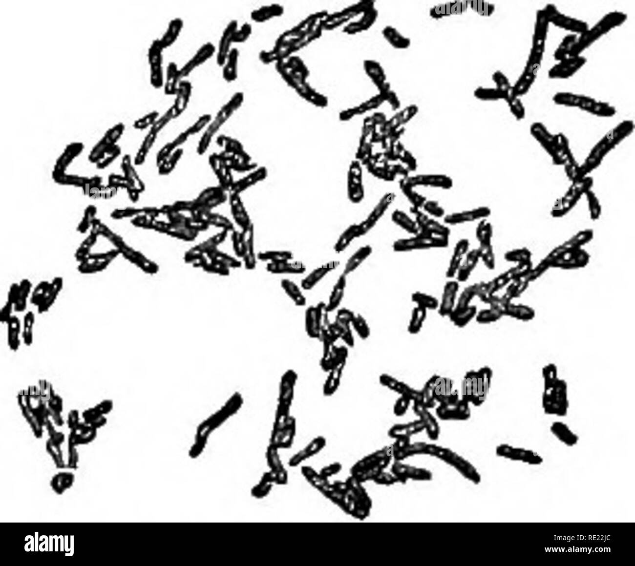 . A text-book of bacteriology. Bacteriology. BACILLI IN CHRONIC ...